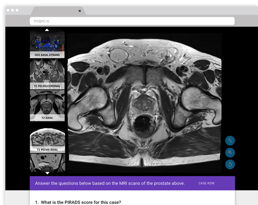 Online Prostate MRI Trainer - MRI PRO